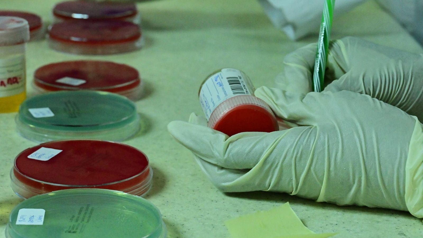 World Anti-Doping Agency to reduce bans for recreational drugs from ...